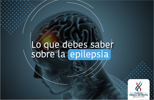 Lo que debes saber sobre la epilepsia - Fundación Clínica del Norte